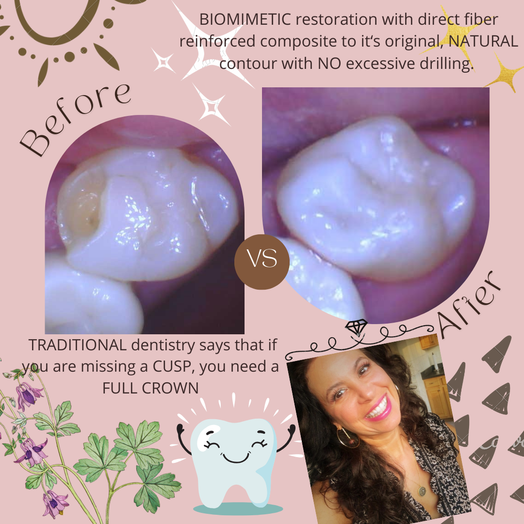 Biomimetic dentistry, minimally invasive dentistry, no drilling ...